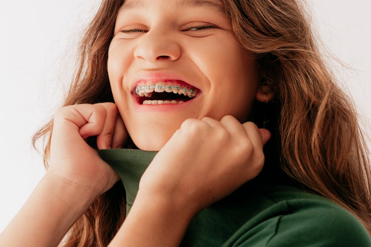 Braces For Teeth • A Complete Guide to Teeth Braces